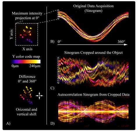 Sinogram Based Analysis Of The Acquired Dataset A Mip At 0° And