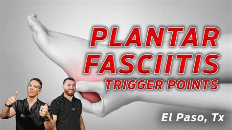 Plantar Fasciitis Trigger Points On The Feet El Paso TX Sciatica Pain And Treatment Clinic