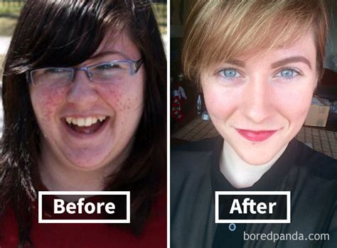 128 Surprising Photos Of Face Fat Loss Before And After Weight Loss