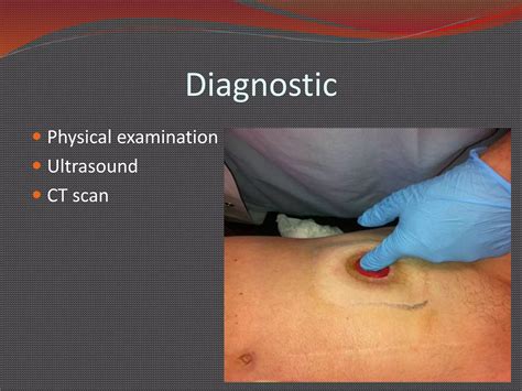 2017parastomal Hernia In Colorectal Cancer Pptx