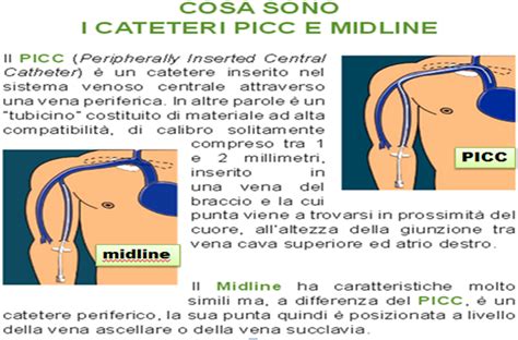 Chiama Informazione Come Cura Differenza Tra Port Picc E Midline