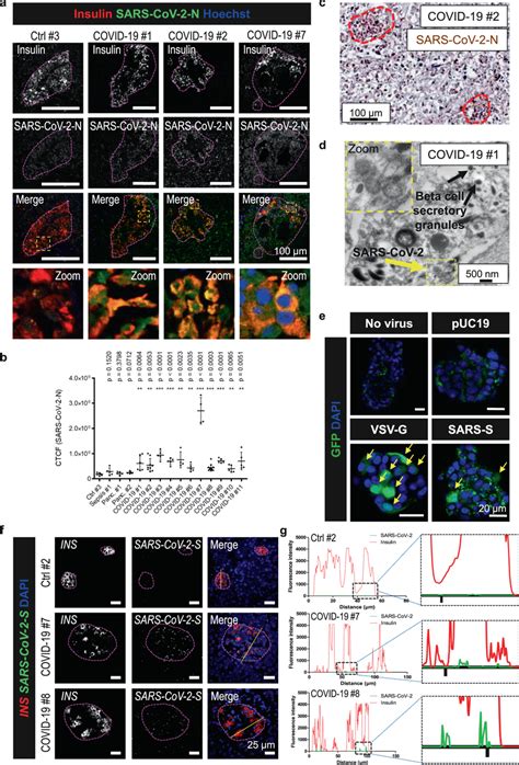 Sars Cov 2 Infection Leads To Viral Infiltration In The Pancreas A Download Scientific Diagram