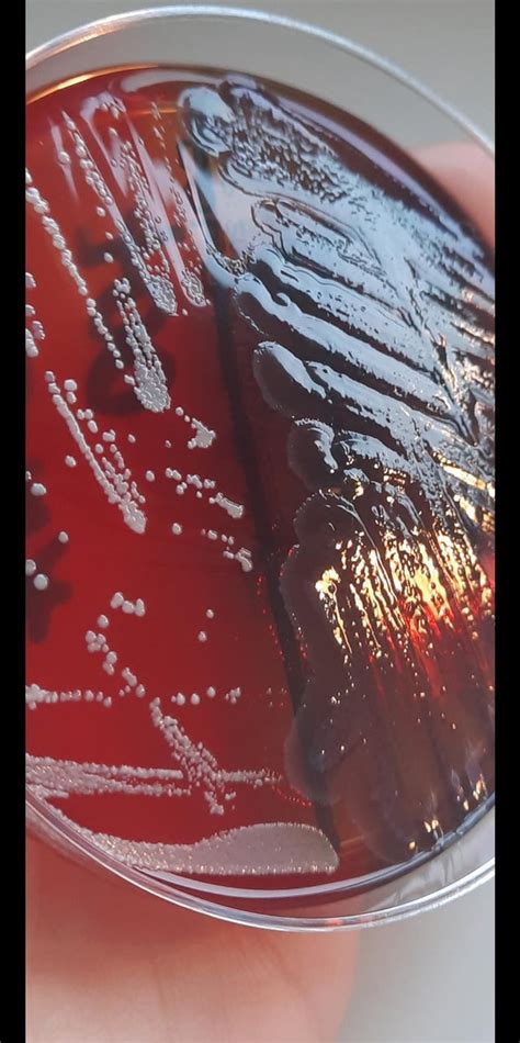 Chop Led Study Shows That Antibiotic Resistant Microbes In The Gut Make