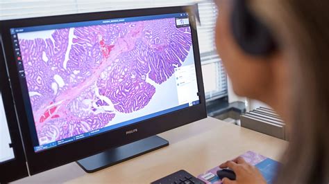 Digital Pathology Idexx Laboratories Philips