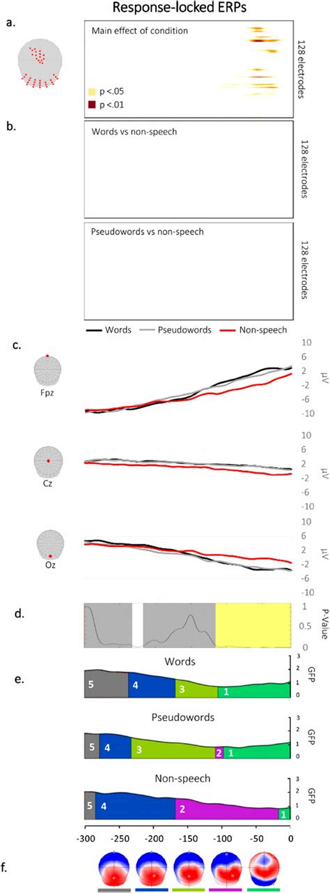 Results Of The Waveform Analysis Displayed On Each Electrode And Each Download Scientific