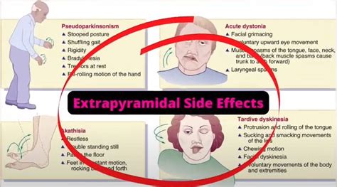 Navigating Extrapyramidal Side Effects A Guide For PMHNP Babes