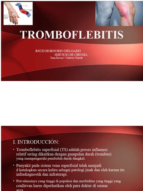 Tromboflebitis Pdf