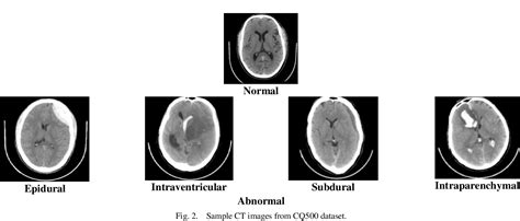 Figure 2 From Federated Convolutional Neural Networks For Predictive