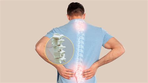 Doctor Answers Faqs Related To Osteoporosis Shares Tips To Prevent