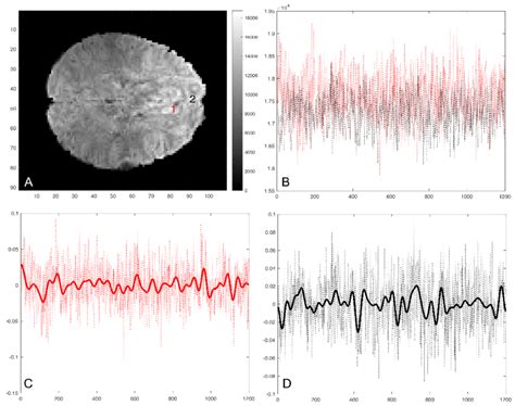A Fmri Time Series At Two Different Voxels At Time Point T 1 B Fmri Download Scientific