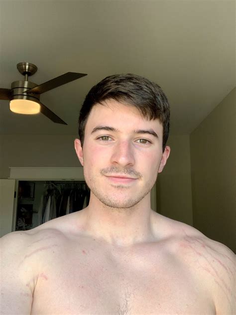 Jack On Twitter Idk I Think My Stretch Marks Are Hot