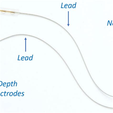 An Example Of A Responsive Neurostimulation Device Rns® System