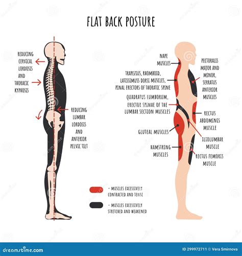 Spine Curves Spinal Deformity Symbol Of Spine Curvatures Or Unhealthy Backbones Human Spine