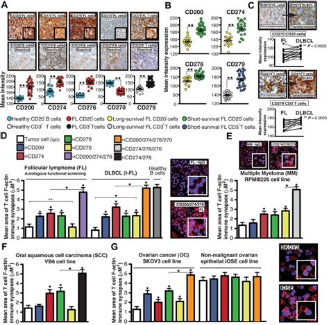 Tumor Induced T Cell Actin Synapse Dysfunction Mediated By Inhibitory