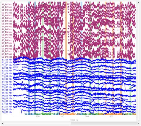 Preprocessing Functional Near Infrared Spectroscopy Fnirs Data — Mne 1 2 2 Documentation