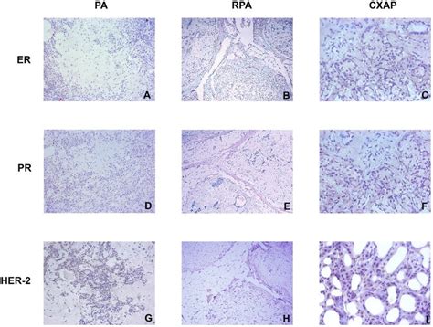 Er Negative Expression In Pa A Rpa B And Cxpa C Pr Negative Download Scientific