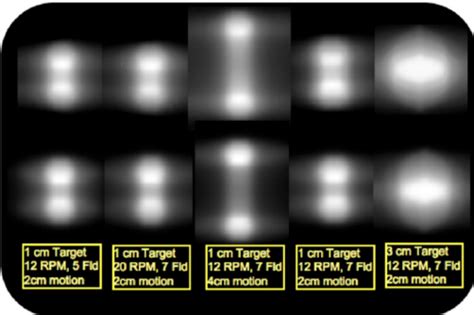 Validation Of The Dose Accumulation Model In The Simulation Framework Download Scientific