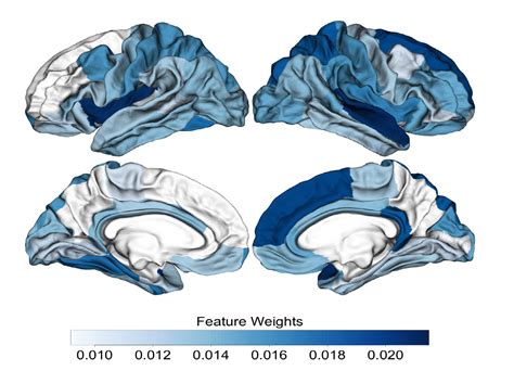 Predicting Psychosis Before It Occurs Mirage News