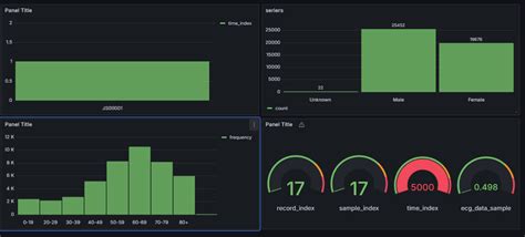 Unveiling The Power Of Ecg Data Analysis For Arrhythmia Detection A Grafana Journey By Waqas
