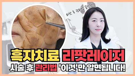 리팟레이저 하고 관리 안하면 돈날리고 고생합니다ㅣ 시술 후 관리법 총정리 흑자레이저 리팟레이저 Youtube