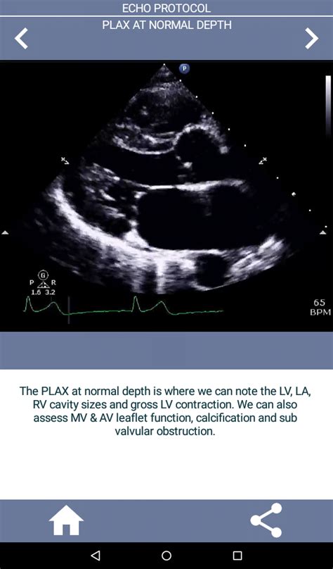 Learn The Full Tte Echo Ultrasound Protocol Demo Uk Appstore For Android