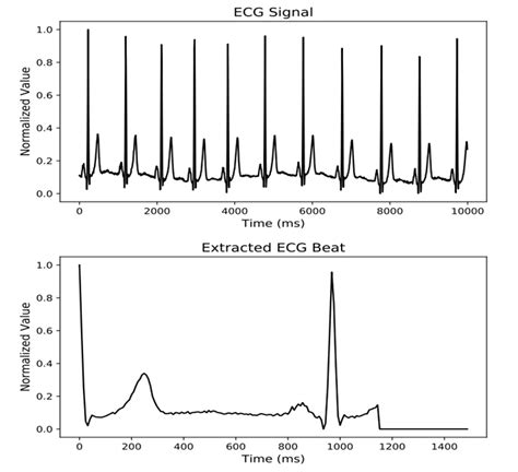 Github Mohdakrory Ai Based Medical Diagnosis System An Ai Based