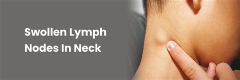 Swollen Lymph Nodes In The Neck Causes And Treatment