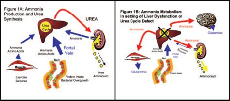 Hyperammonemia In The Icu Chest