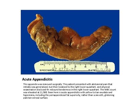 Gi Lab 2 Small And Large Intestines Normal