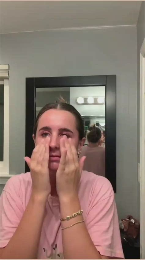 Overnight Sunburn Remedies Perfect Skin Care Routine Sunburn