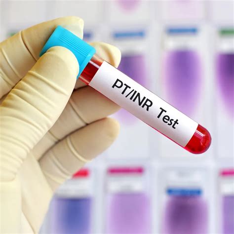 Coagulation Test Isolated Prolongation Of Activated Partial