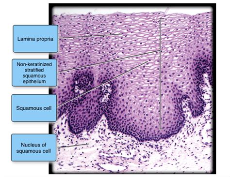 Keratinized Vs Non Keratinized Stratified Squamous Epithelium