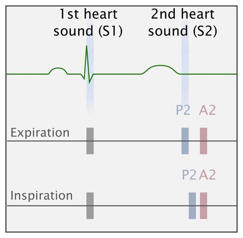 Ekg Heart Sounds On