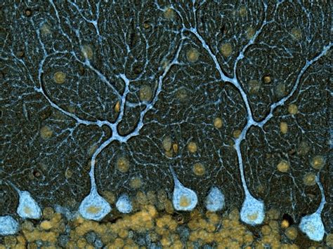 Mouse Purkinje Brain Cells Nikon Small World