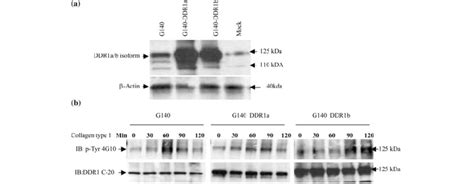 Expression And Phosphorylation Of Ddr1a Ddr1b In G140 Glioma Cell Download Scientific Diagram Expression And Phosphorylation Of Ddr1a Ddr1b In G140 Glioma Cell Download Scientific Diagram