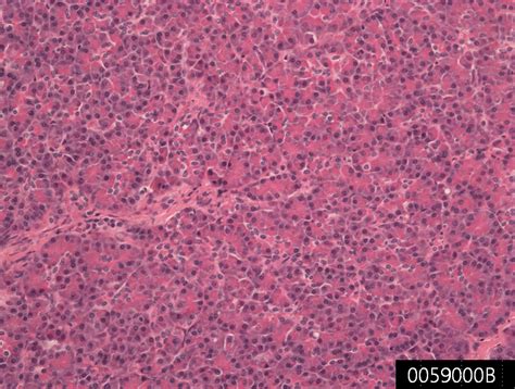 Pancreas Normal Xelonet