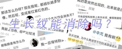 长了生长纹不要害怕，可以这样淡化它 知乎