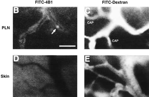 Intracutaneously Injected TCA Specifically Accumulates In Draining Download Scientific