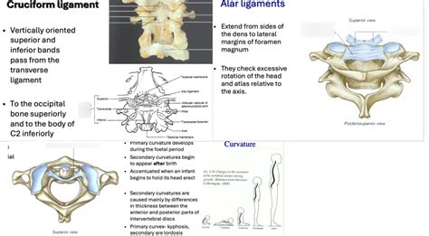Diagram Of 3 Cruciform Ligament And Alar Ligament Quizlet