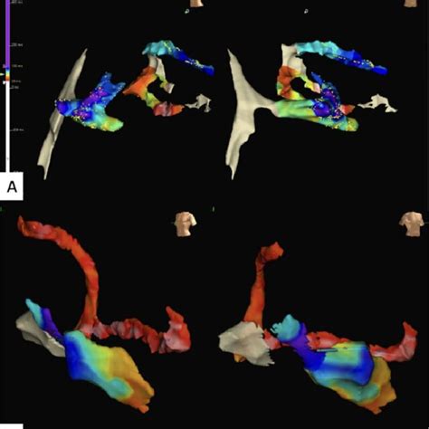 Examples Of Activation Pattern Download Scientific Diagram