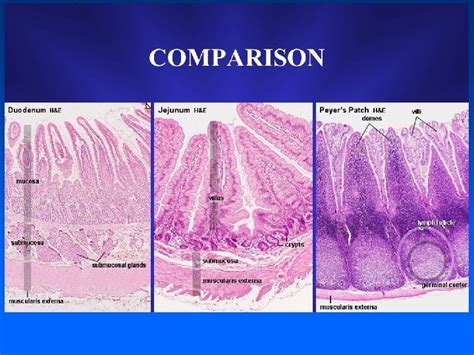 Small Intestine Ii Jejunum And Ileum Dr Anna