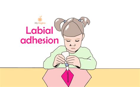 Understanding Labial Adhesion Causes Treatments