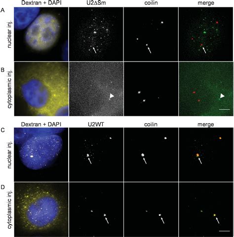 Video Analysis Of Spliceosomal Snrna Localization In Human Hela Cells