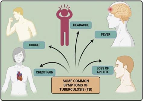 Tuberculosis Signs And Symptoms
