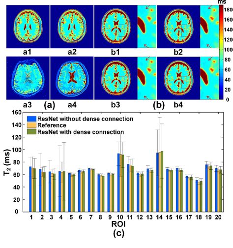 Figure 7 From Robust Single Shot T2 Mapping Via Multiple Overlapping