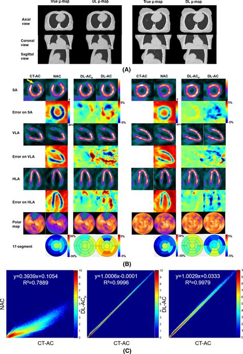 Deep Learning Based Estimation Of Attenuation Map Improves Attenuation