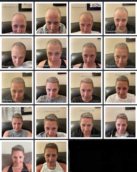 Hair Growth Styling Tips For Short Hair After Chemo Artofit