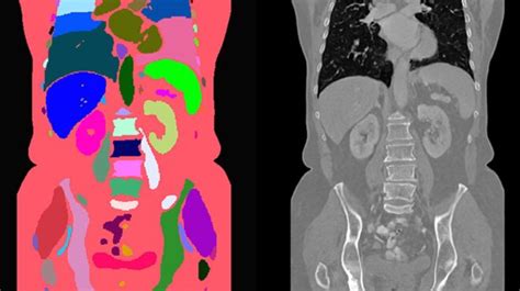 Addressing Medical Imaging Limitations With Synthetic Data Generation