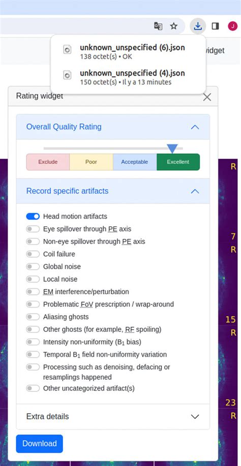 Mriqc Rating Widget For Large Datasets And Submission To The Api Software Support Neurostars