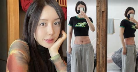 돌싱글즈3 이소라 코·가슴 성형 이어 지방흡입까지 몸 엄청 부어